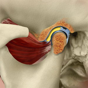 TMJ Specialist Beverly Hills CA Temporomandibular Joint Treatment Los Angeles